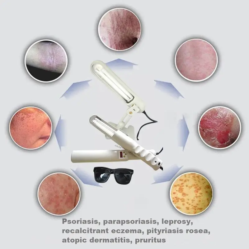 UV 311nm Phototherapy Device with Philips UVB Lamp for Skin | Inspire ...