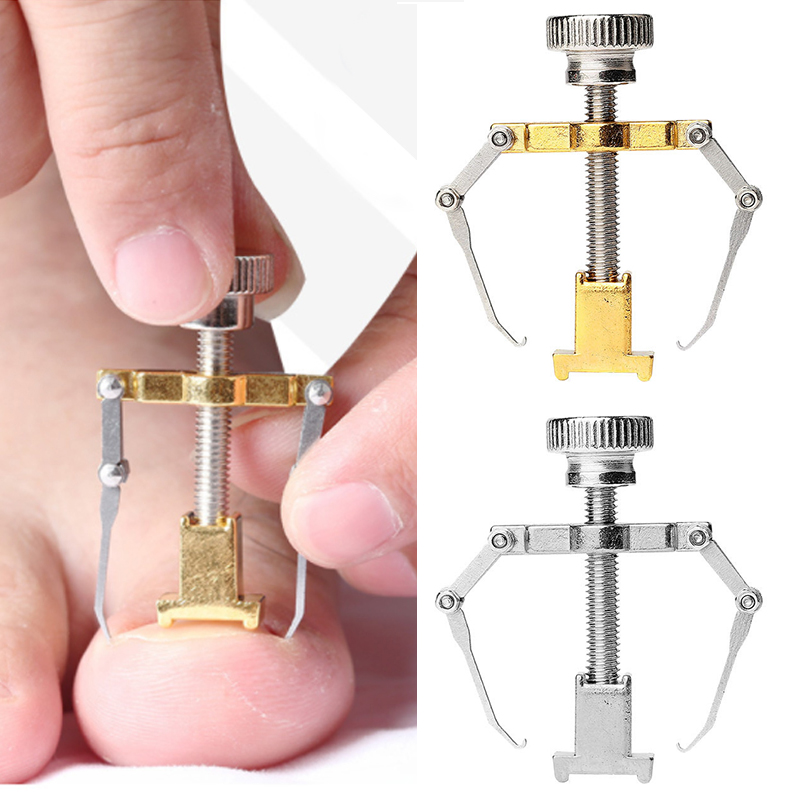 Ingrown Toenail Corrector Nail Lifter Foot Care Tool | Inspire Uplift